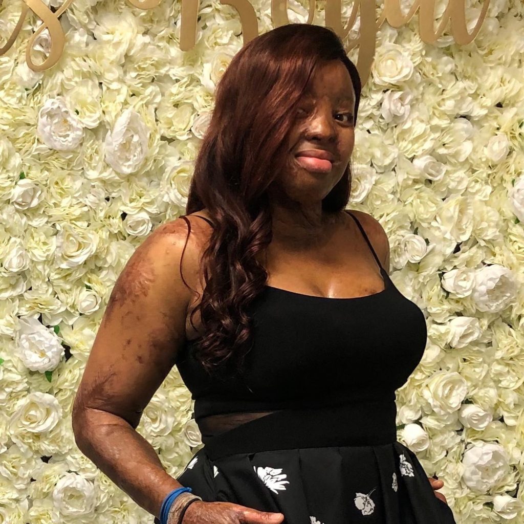 Kechi Okwuchi remembers the tragic plane crash that took 108 lives