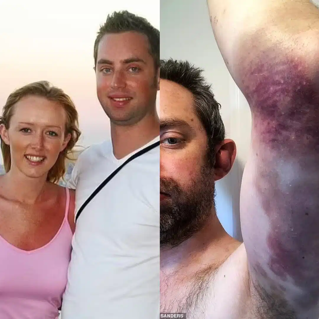 "I wear makeup to cover bruises" — Man opens up after 20 years of ...