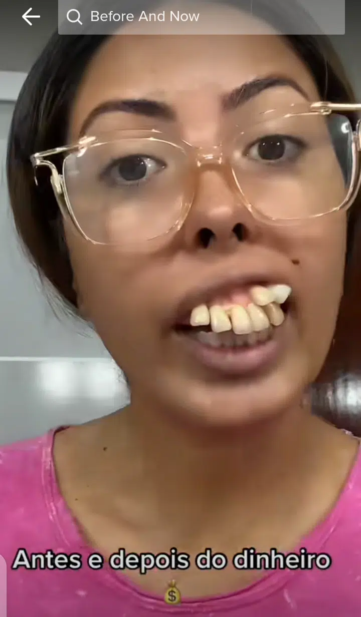 "Power of money" - Lady with crooked teeth shows off new look