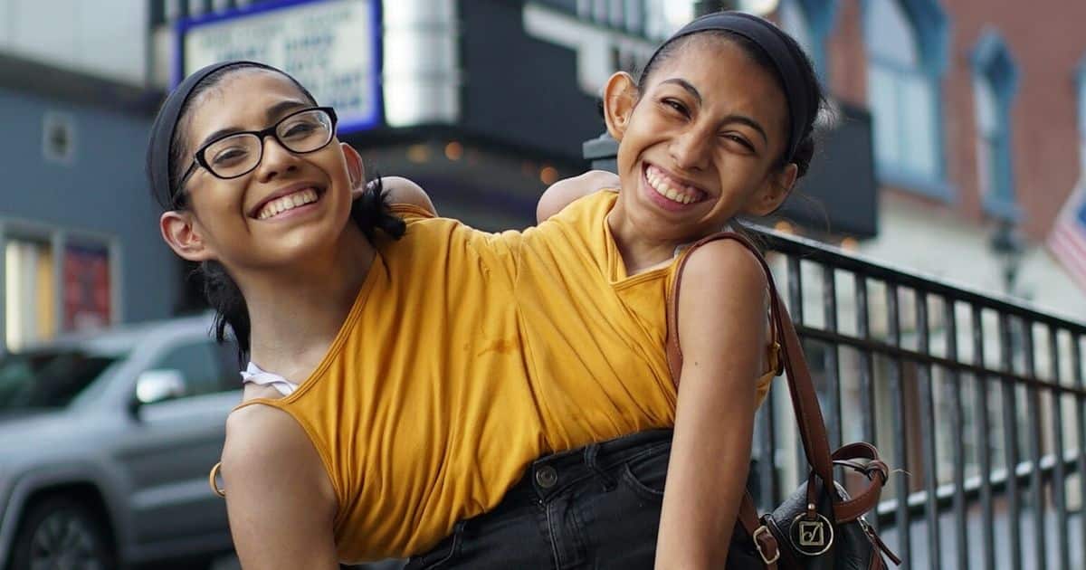 "We share the same vagina but only one of us has a boyfriend" - Conjoined twins