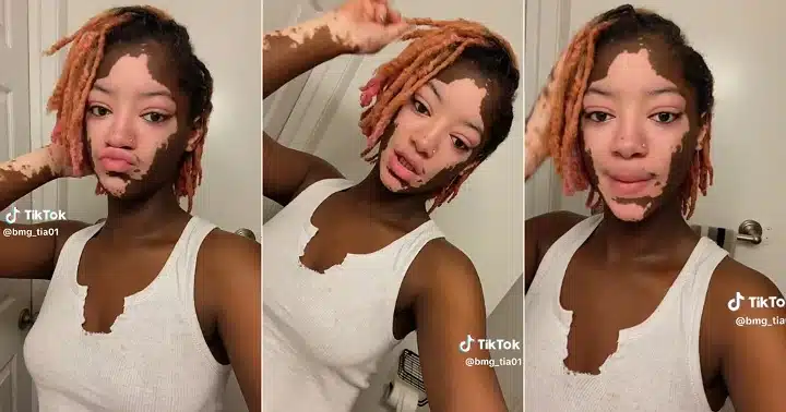 Lady with 2-toned face causes buzz online, video goes viral