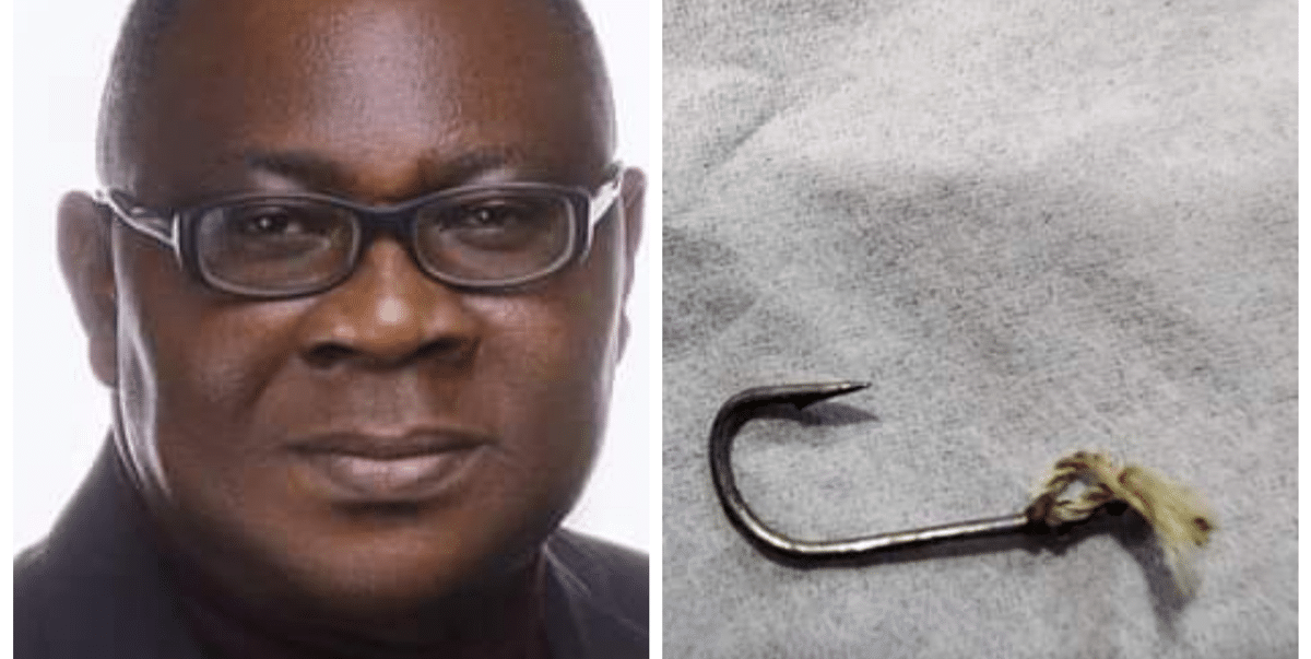 Man narrowly escapes swallowing metal hook in soup while eating at a ...