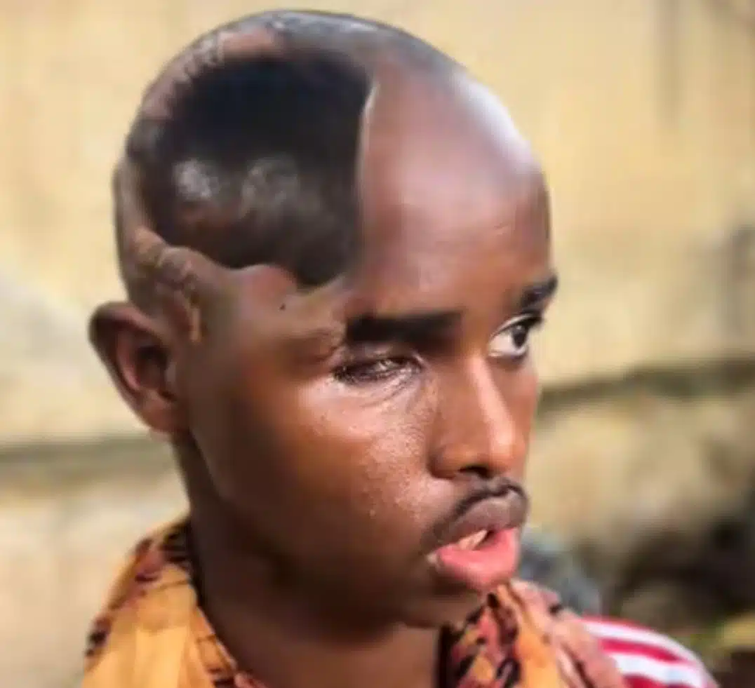 Video of man with open skull generates buzz as it surfaces online