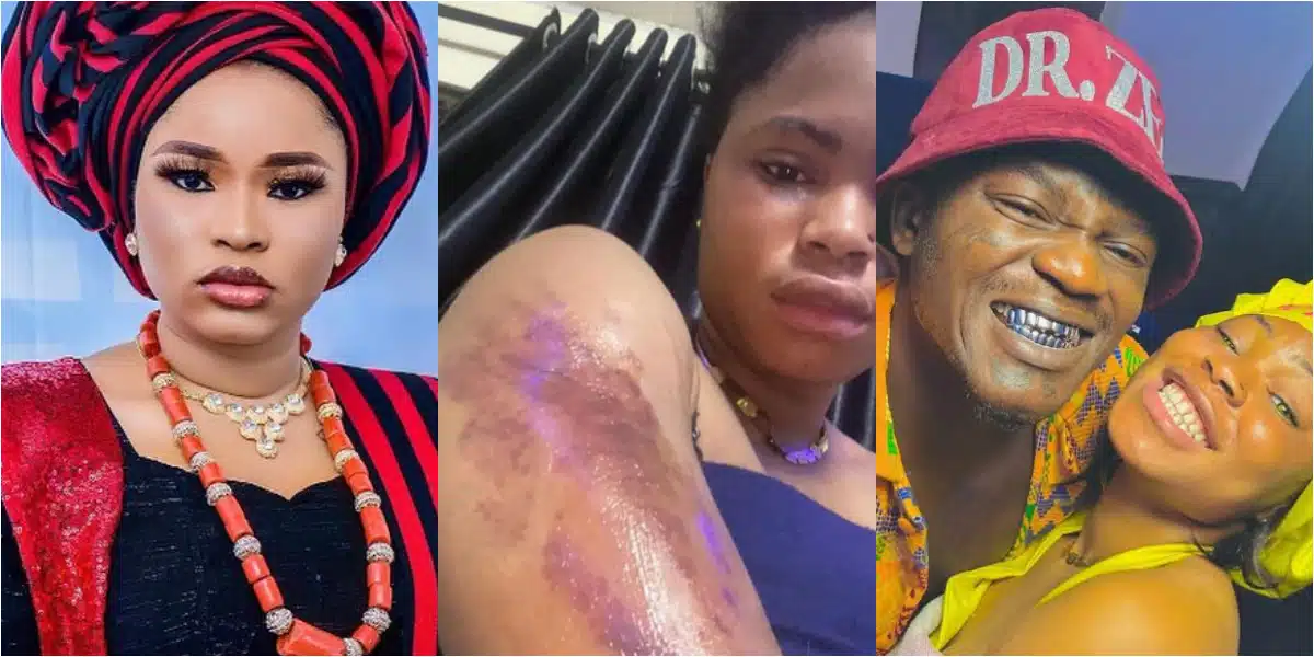 Portable's wife Bewaji reacts to domestic violence accusations after photos of battered body ...