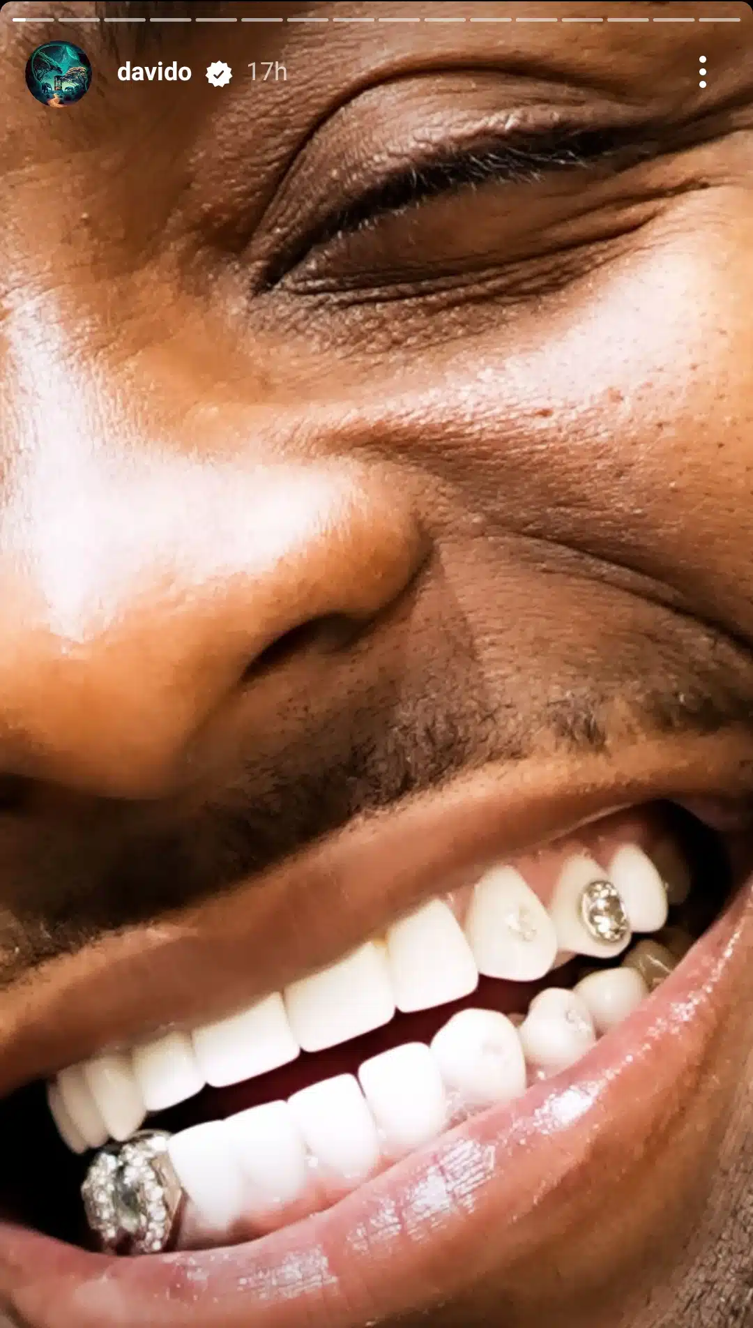 Davido flaunts newly acquired diamond teeth, gold necklace